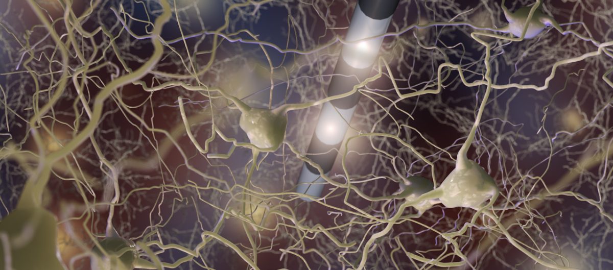Deep Brain Stimulation Society